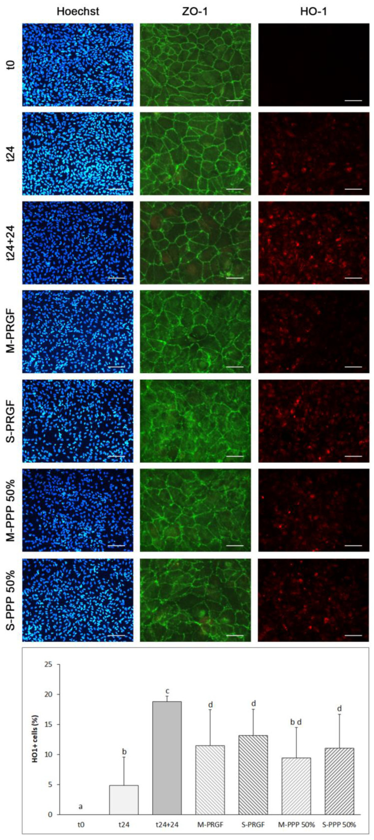 PRGF Membrane with Tailored Optical Properties Preserves the ...