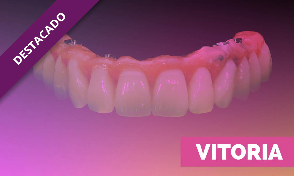 Técnicas avanzadas de prótesis – BTI Training Center