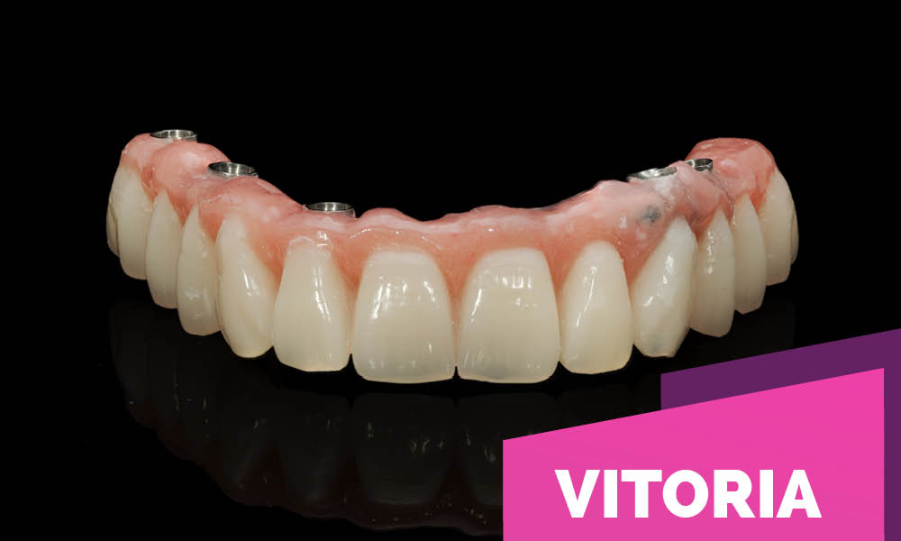 Técnicas avanzadas de prótesis – COMPLETO – BTI Training Center