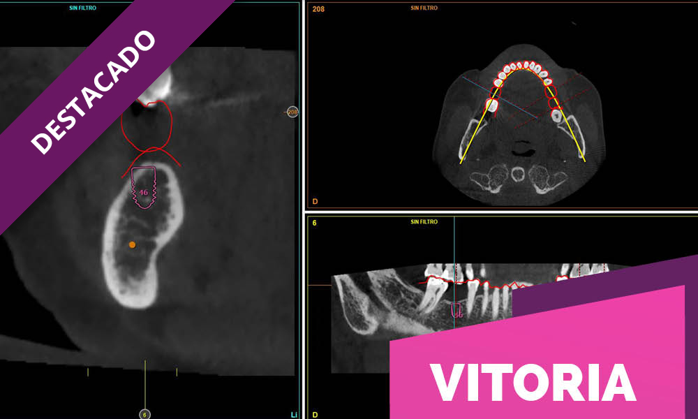 Introducción al Software BTI SCAN® – BTI Training Center